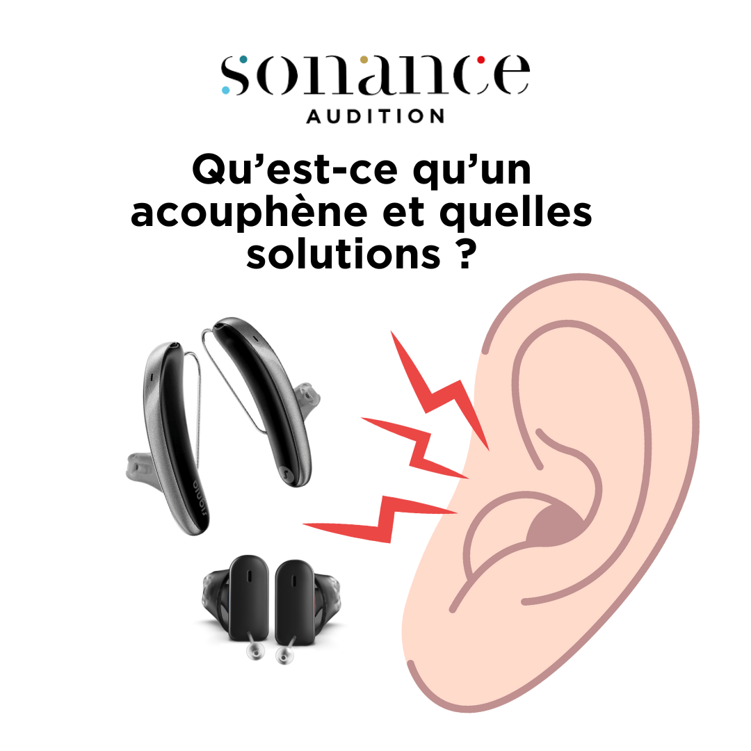 Les aides auditives efficaces contre les acouphènes. - Sonance Audition